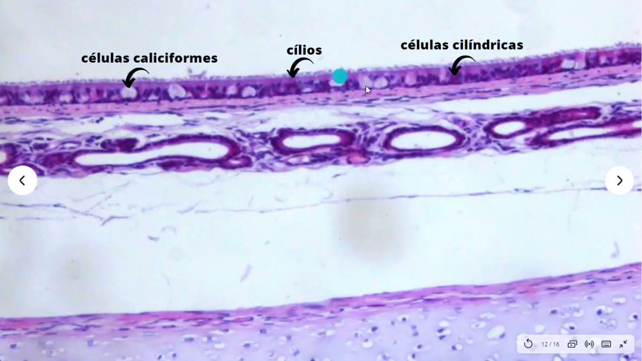 Celulas Caliciformes De Histologia Da Traqueia