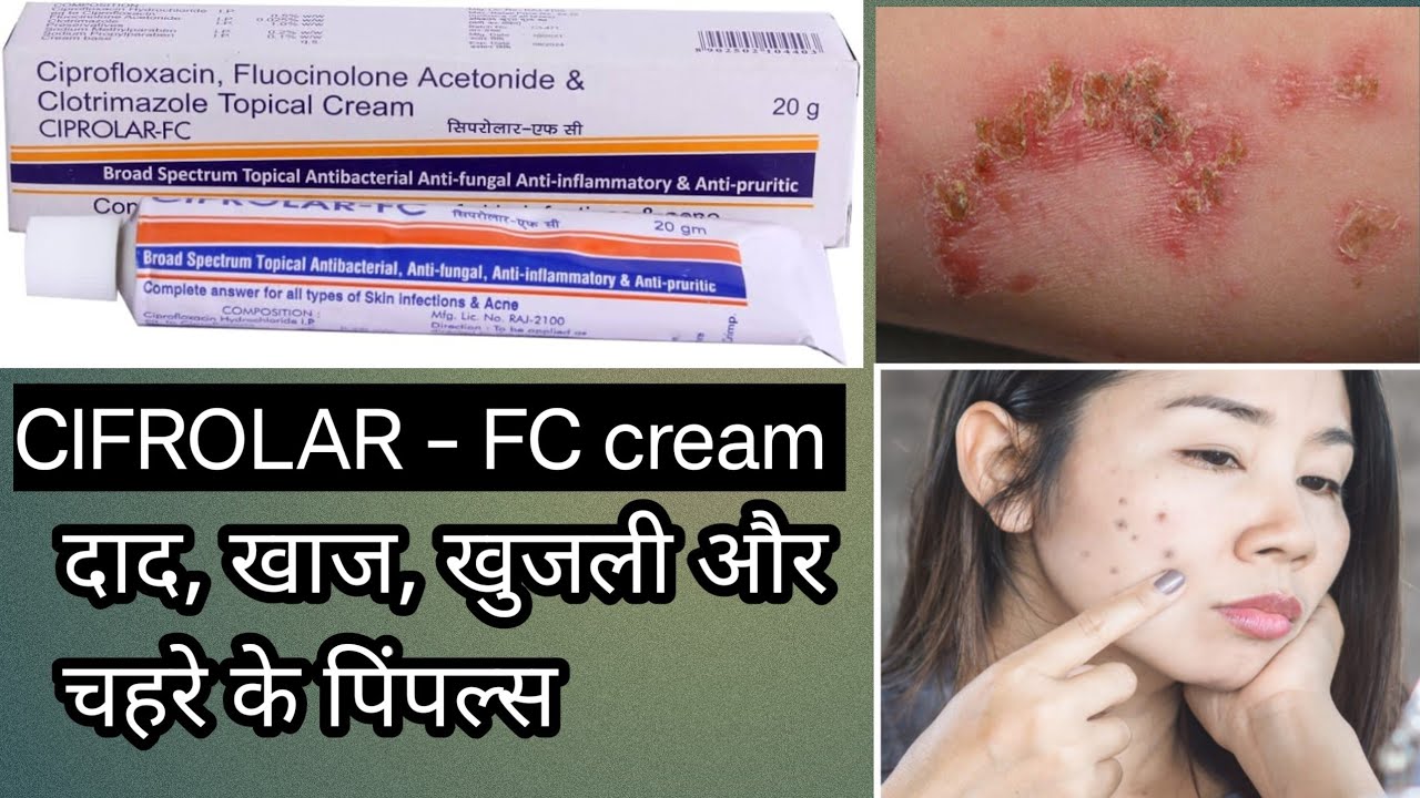 Ciprolar fc cream | Ciprolar fc cream ke fayde | दाग धब्बे फोड़े फुंसी ...