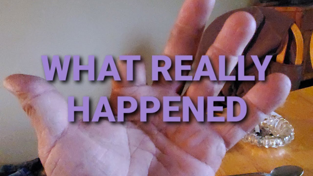 Farm Accident = Missing Fingers - YouTube