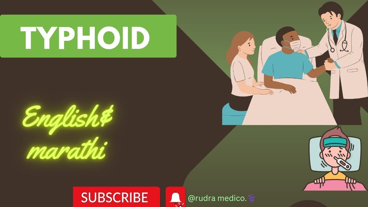 Typhoid Fever | Defination,Causes,Type,Symptom,Clinical feature ...