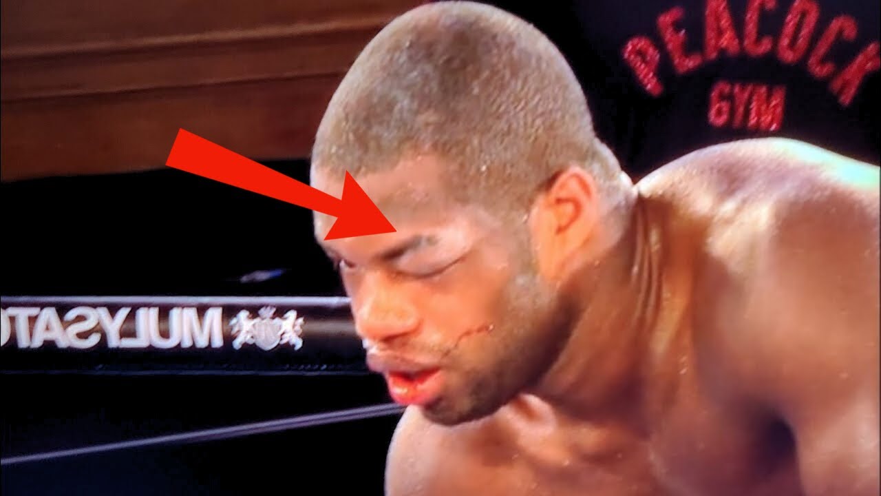 ALL Daniel Dubois Knockout Losses! - YouTube