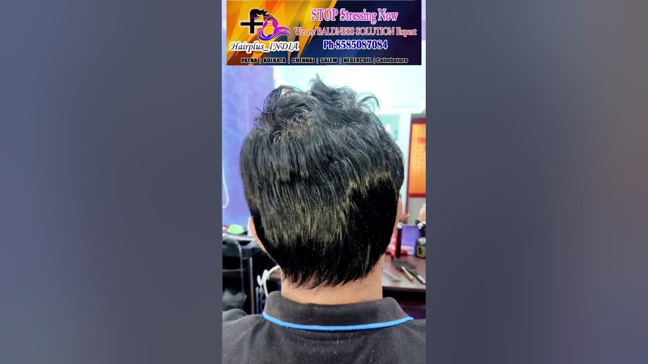 Hair🧑‍🦲Solution🧒 #shorts #Hair - YouTube