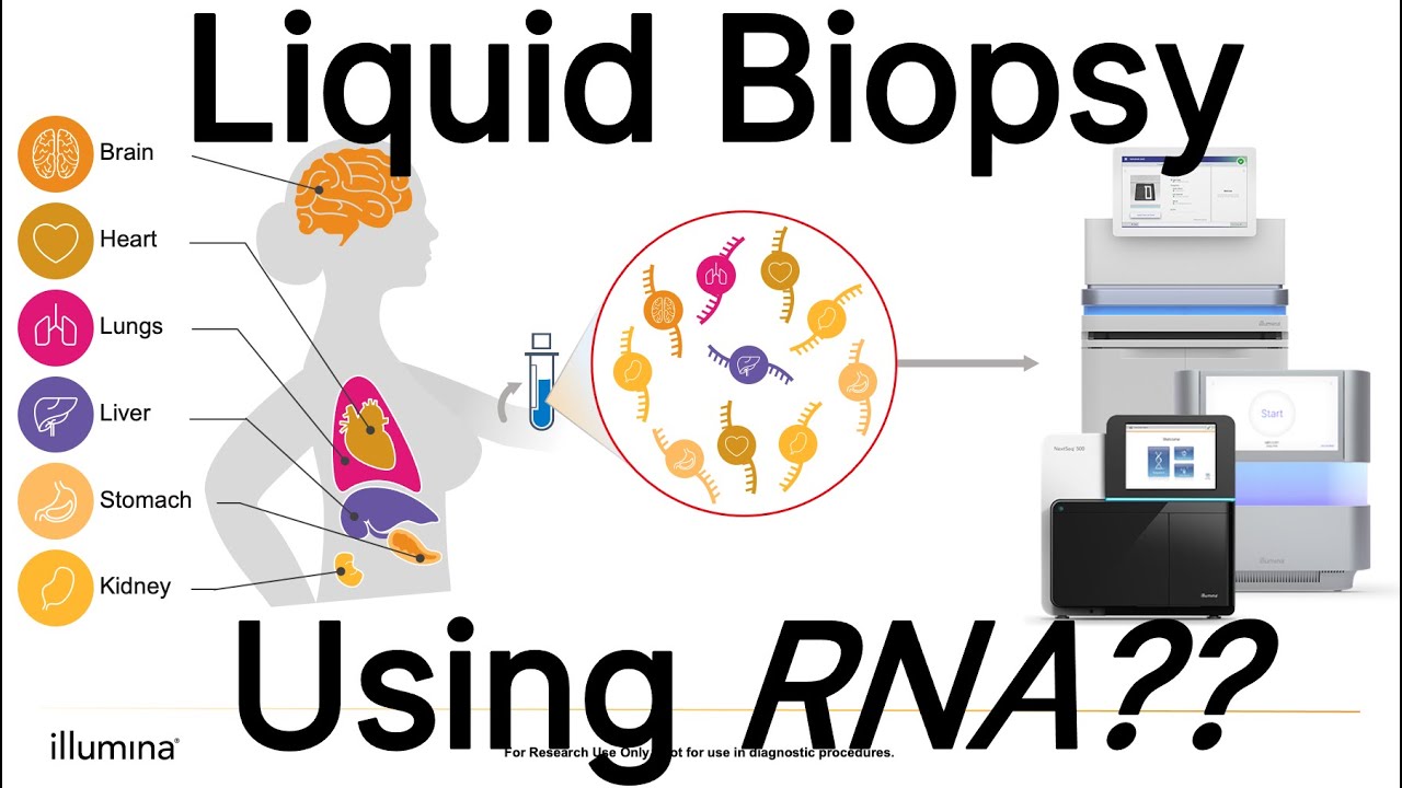 Advancements in Translational Biomarker Identification from Cell-Free ...