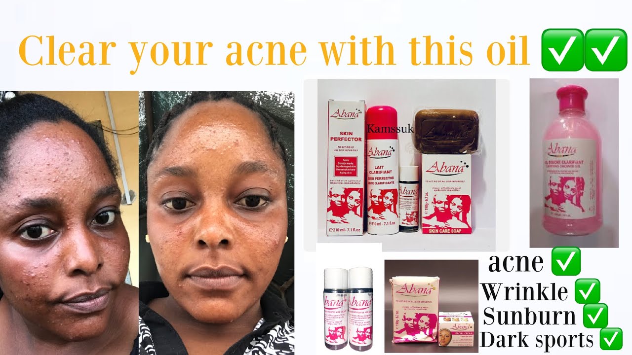 ABANA FACIAL SERUM 😍|| REVIEW ON ABANA PRODUCTS 😳 MY HONEST REVIEW 😍 ...