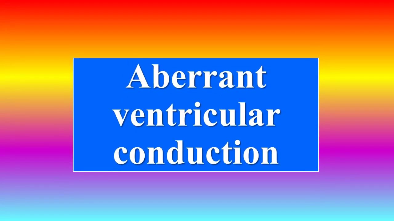 Aberrant ventricular conduction - YouTube