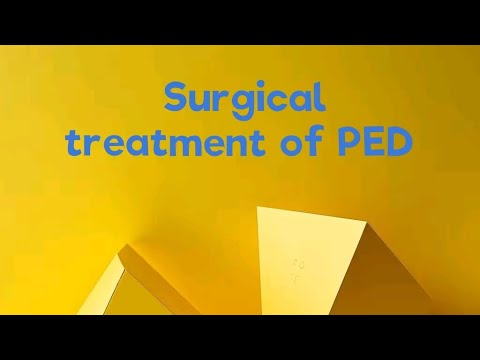 PED的手术治疗（Surgical treatment of PED ） - YouTube