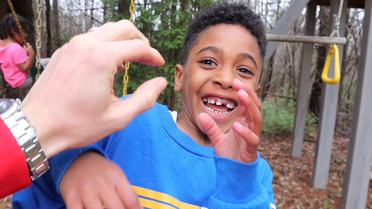 PULLED OUT YOUR TOOTH PRANK - YouTube