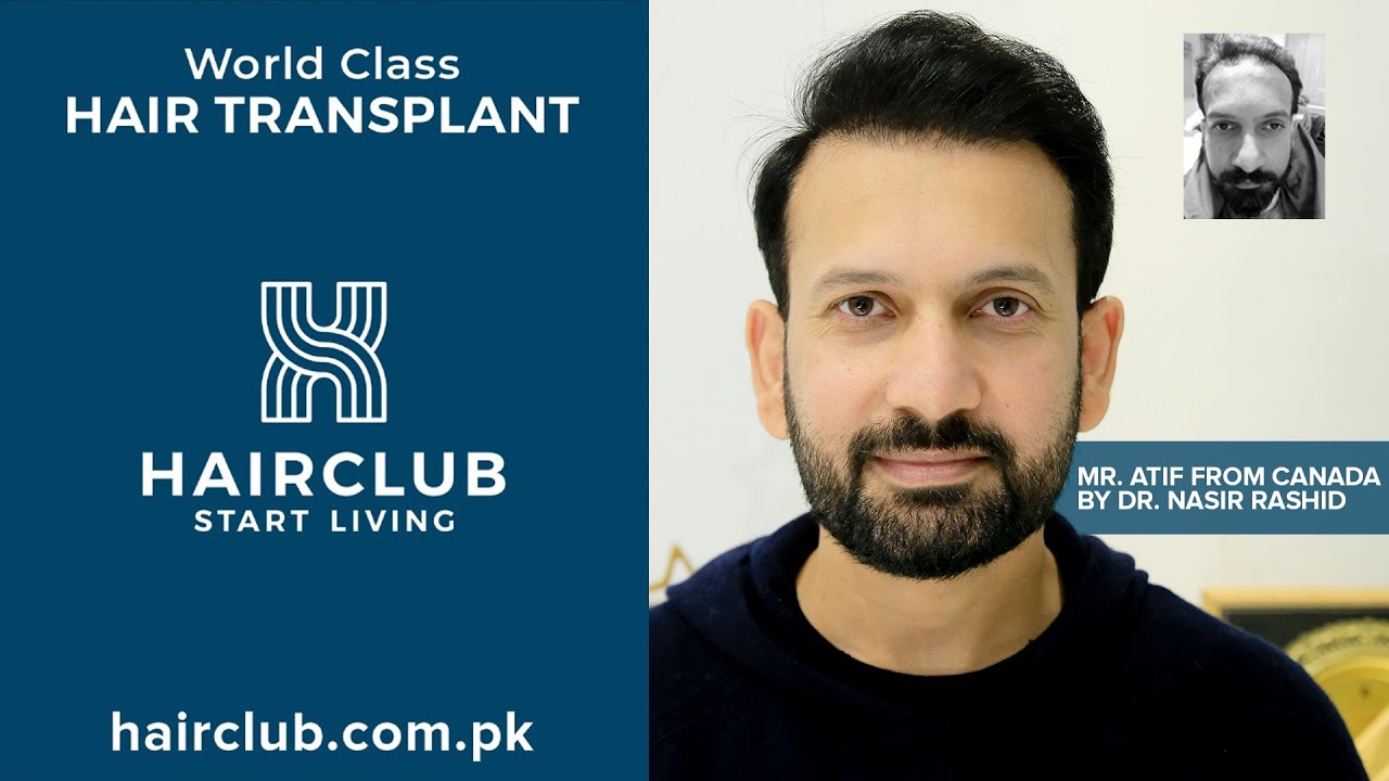 Hair Transplant Journey from Canada to Pakistan. Mr. Atif Visited Dr ...