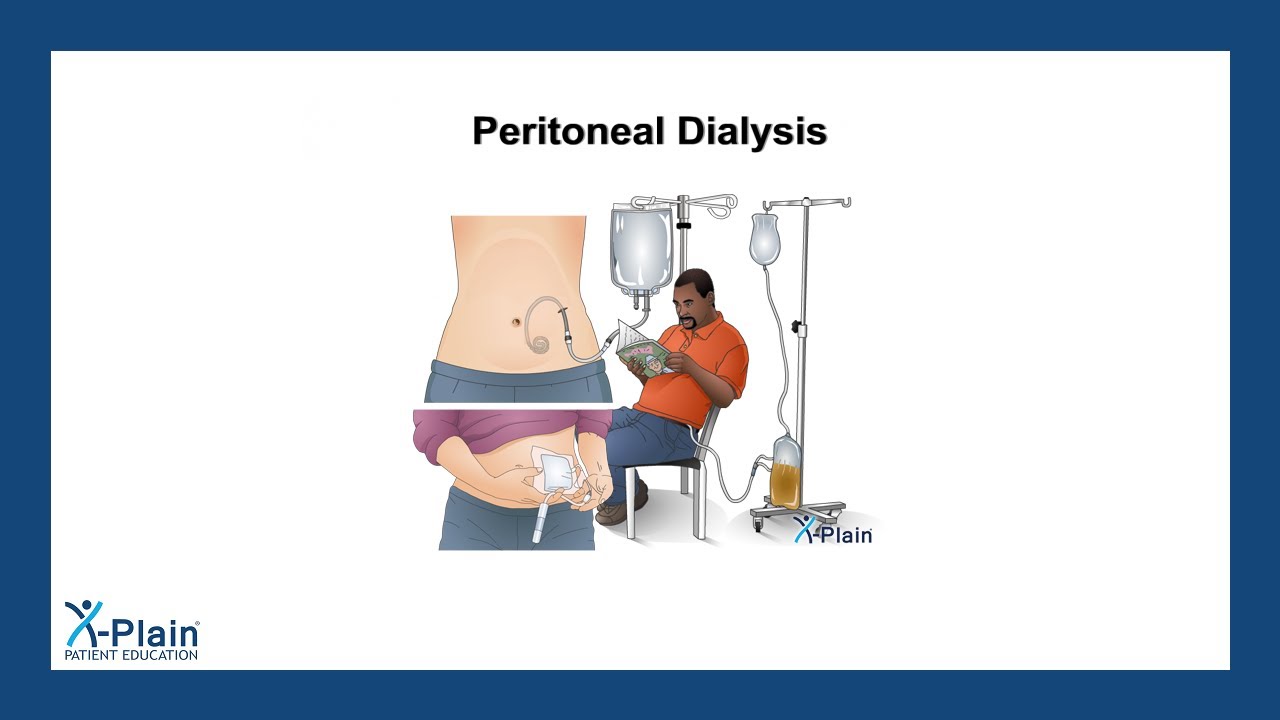Peritoneal Dialysis - YouTube