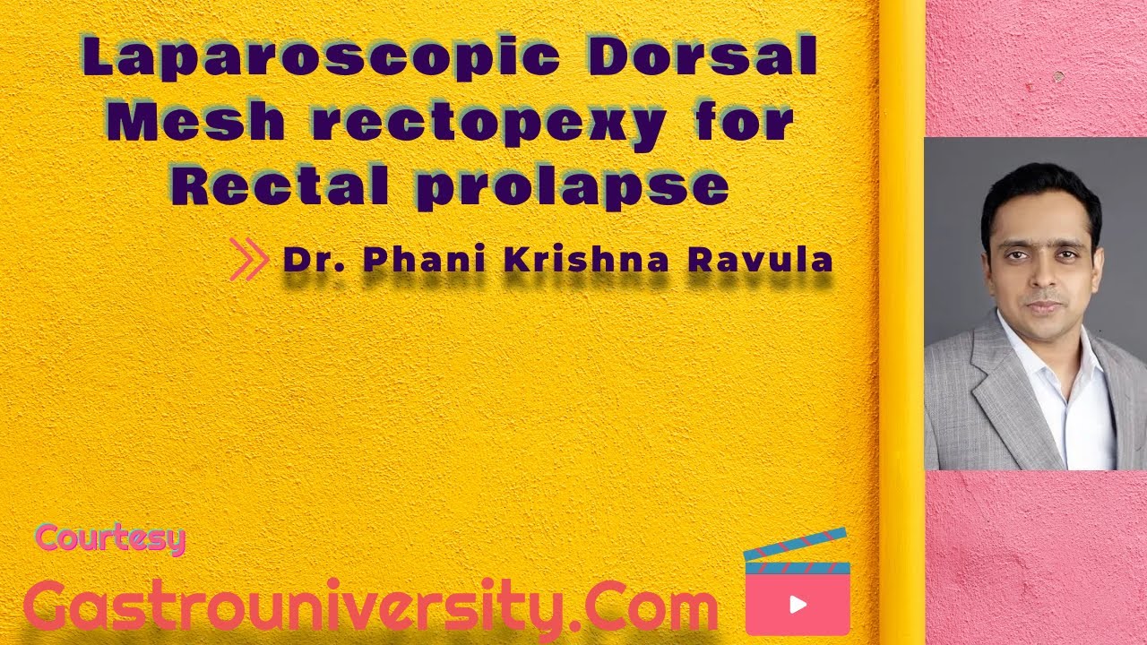 Rectum-Laparoscopic Dorsal Mesh rectopexy for Rectal prolapse - YouTube
