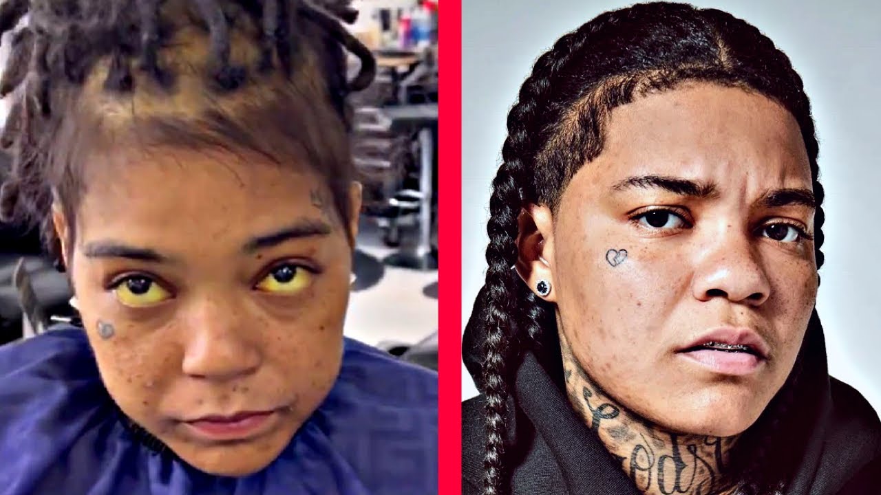Young M.A. Explains Why Her Eyes Are Yellow "I Was Hospitalized" - YouTube