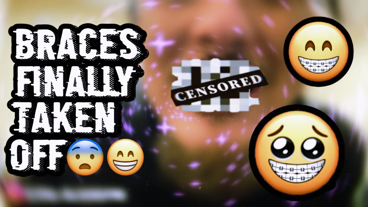 I FINALLY GOT MY BRACES TAKEN OFF AFTER 2 YEARS!! WHAT TO EXPECT WITH A ...