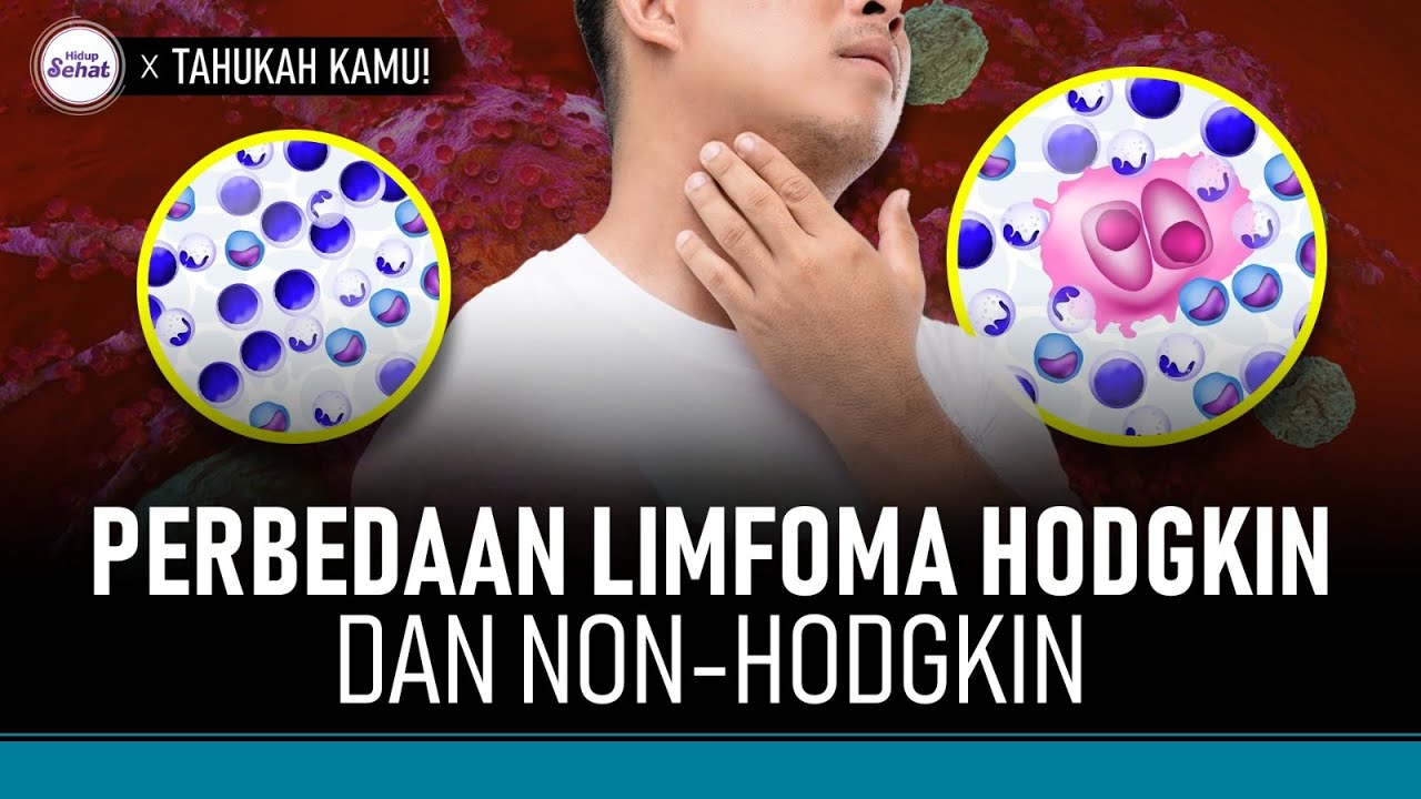 Kanker Limfoma Hodgkin vs Non-Hodgkin, Apa Bedanya? | Hidup Sehat tvOne ...