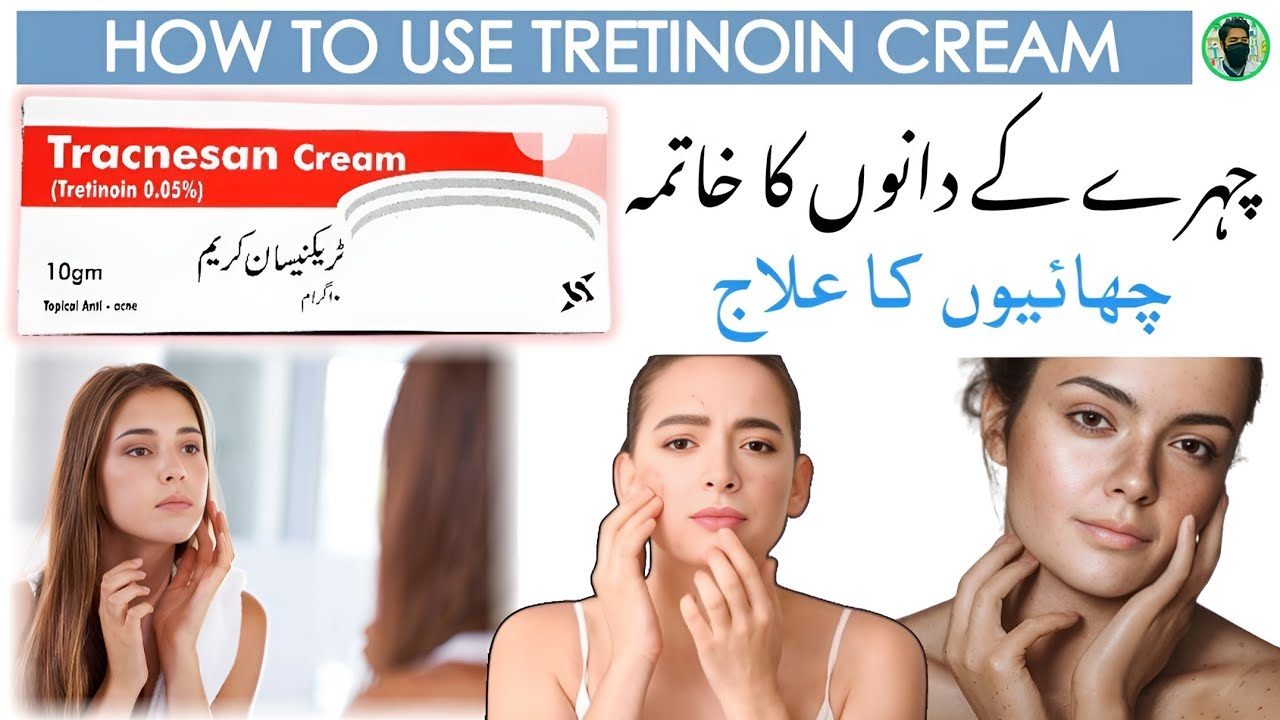 how to use tretinoin cream | tracnesan cream review | acne treatment ...