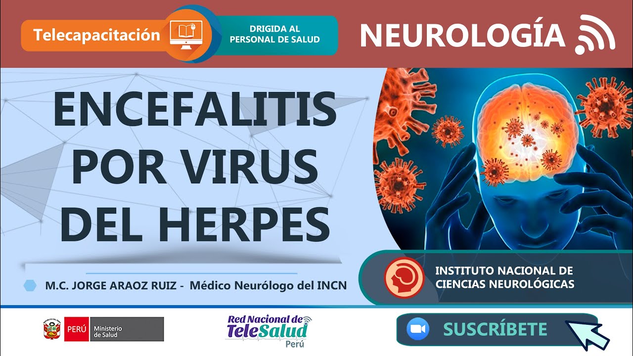 ENCEFALITIS VIRAL HERPÉTICA - YouTube