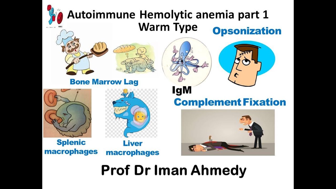 Autoimmune Hemolytic Anemia part 1 Warm type - YouTube