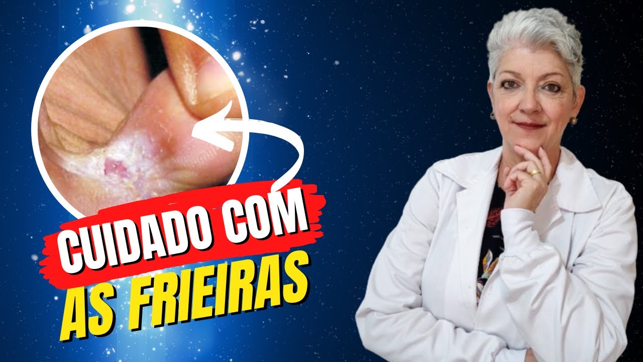 CUIDADO com a FRIEIRA ela pode se tornar PERIGOSA - YouTube