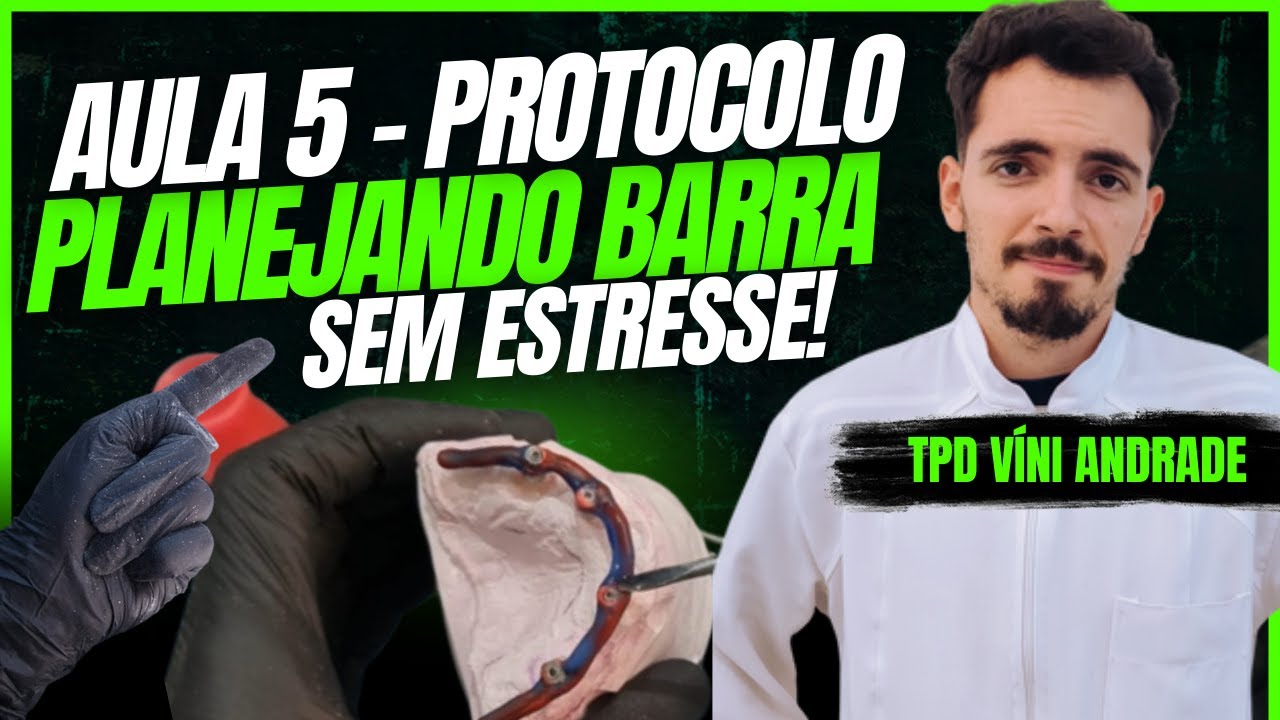 O segredo para o PLANEJAMENTO DE BARRA SEM ESTRESSE - Aula 5 | PRÓTESE ...