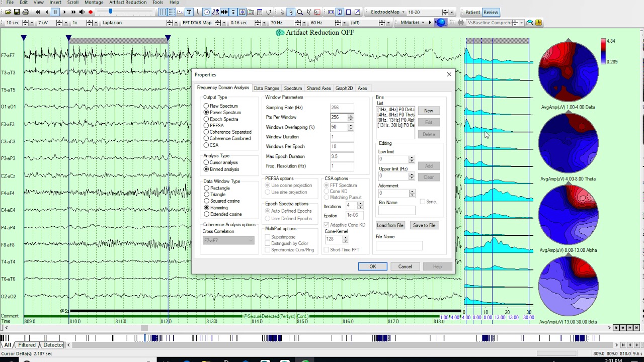 EEG FFT Frequency Maps in Persyst 14 - YouTube
