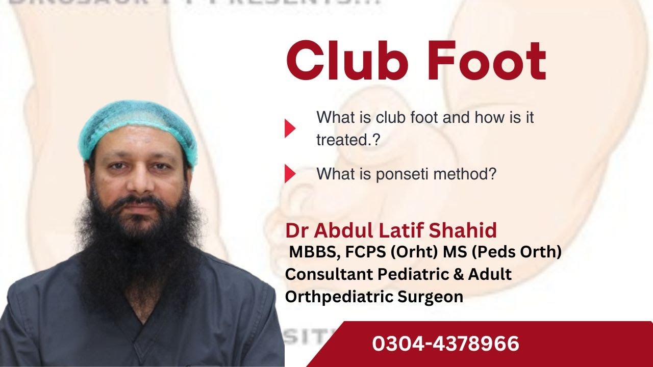 1. ClubFoot | CTEV | Ponseti Method | Tenotomy | PMR | Foot Deformity ...