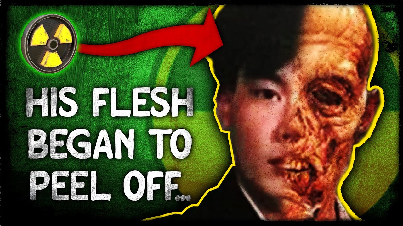 The Man Who Cried Blood - Hisashi Ouchi's Slow and Gruesome D*ath - YouTube