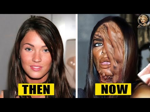 18 Disastrous Plastic Surgeries of Celebrities THEN and NOW | Then and Now 2026
