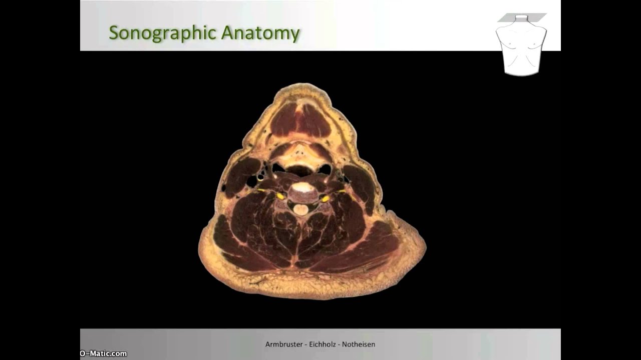 Cervical Plexus Block - Understanding the Cervical Nerves Pathway Pt 1 ...