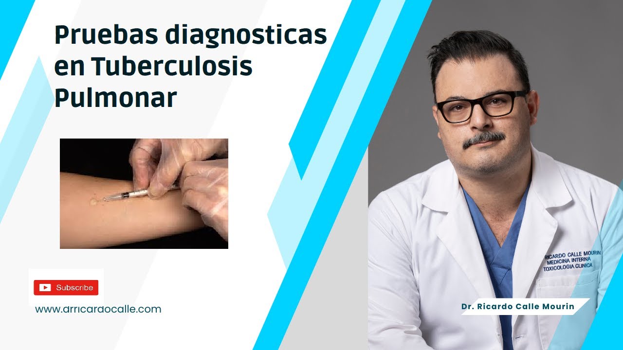 Diagnostico en Tuberculosis Pulmonar | Exámenes de diagnostico - YouTube Music