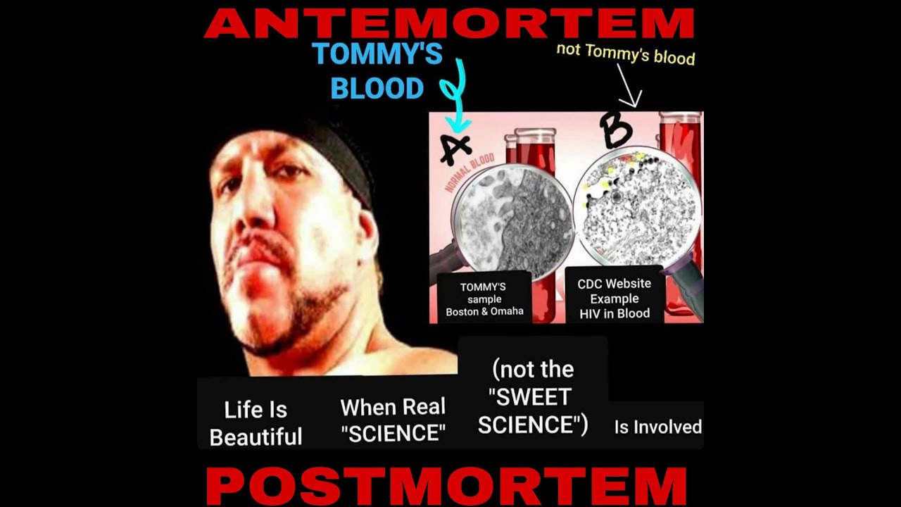 TOMMY MORRISON: ANTEMORTEM & POSTMORTEM PATHOLOGY REPORTS - YouTube