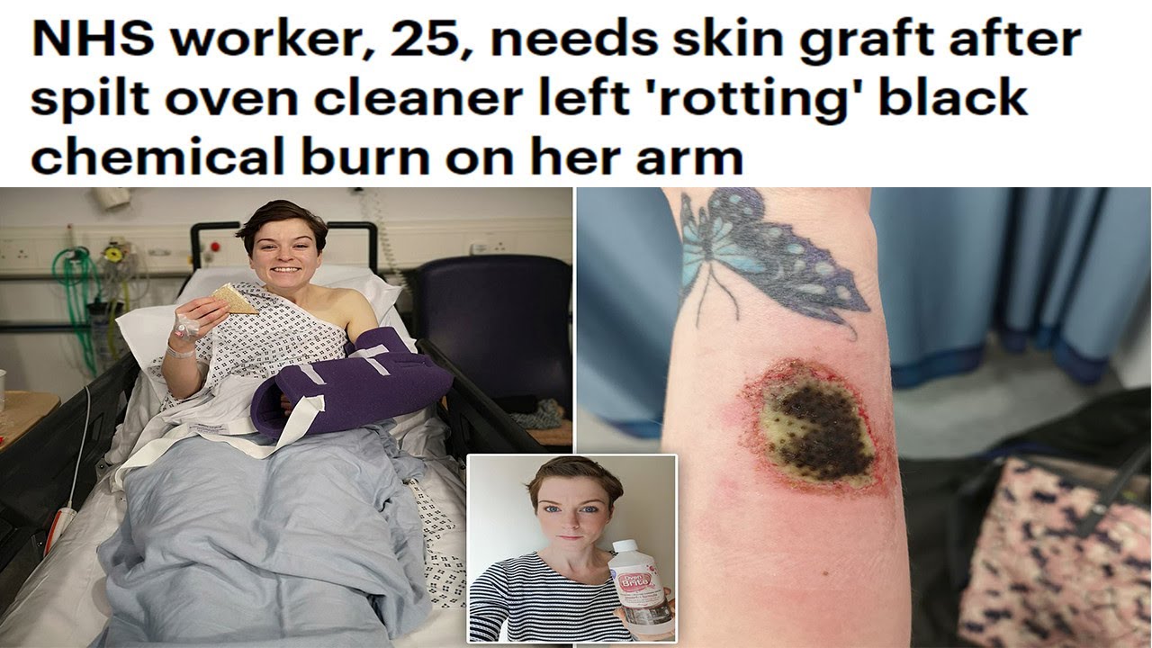 r/WellThatSucks | Her Arm Rotted! - YouTube