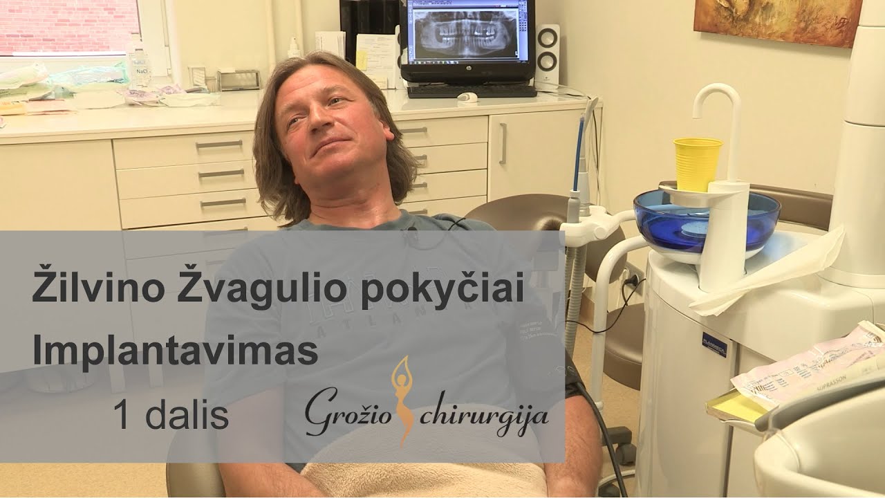 Dantų implantavimas - Žilvino Žvagulio pokyčiai #01- Grožio chirurgija ...
