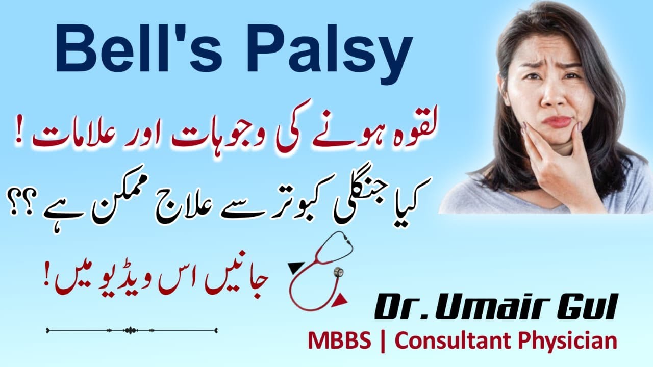 Bell’s palsy-laqwa ka ilaj |Facial paralysis causes & treatment # ...