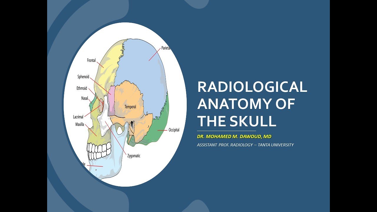 Radiological Anatomy of the Skull - YouTube