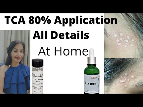 TCA Cross 80% Application At Home|| All Details|| TCA cross किन स्कार्स ...