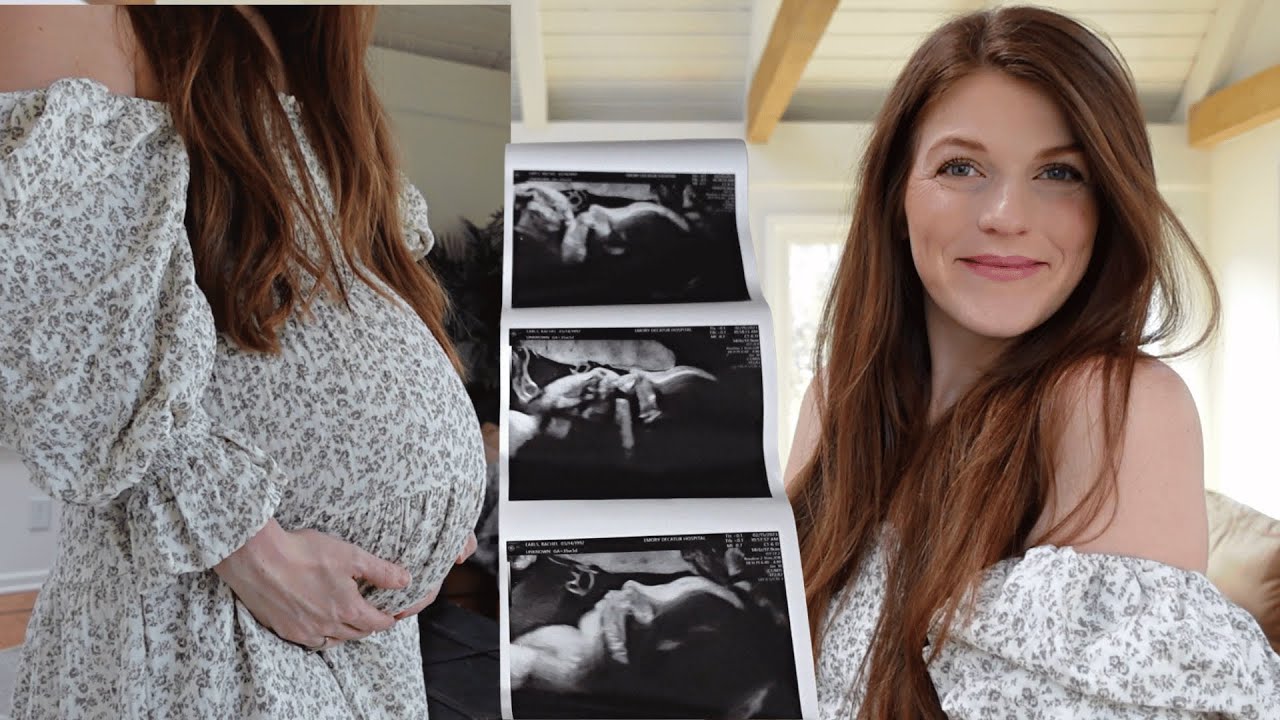 35 week Growth Scan & Gestational Diabetes Update - YouTube