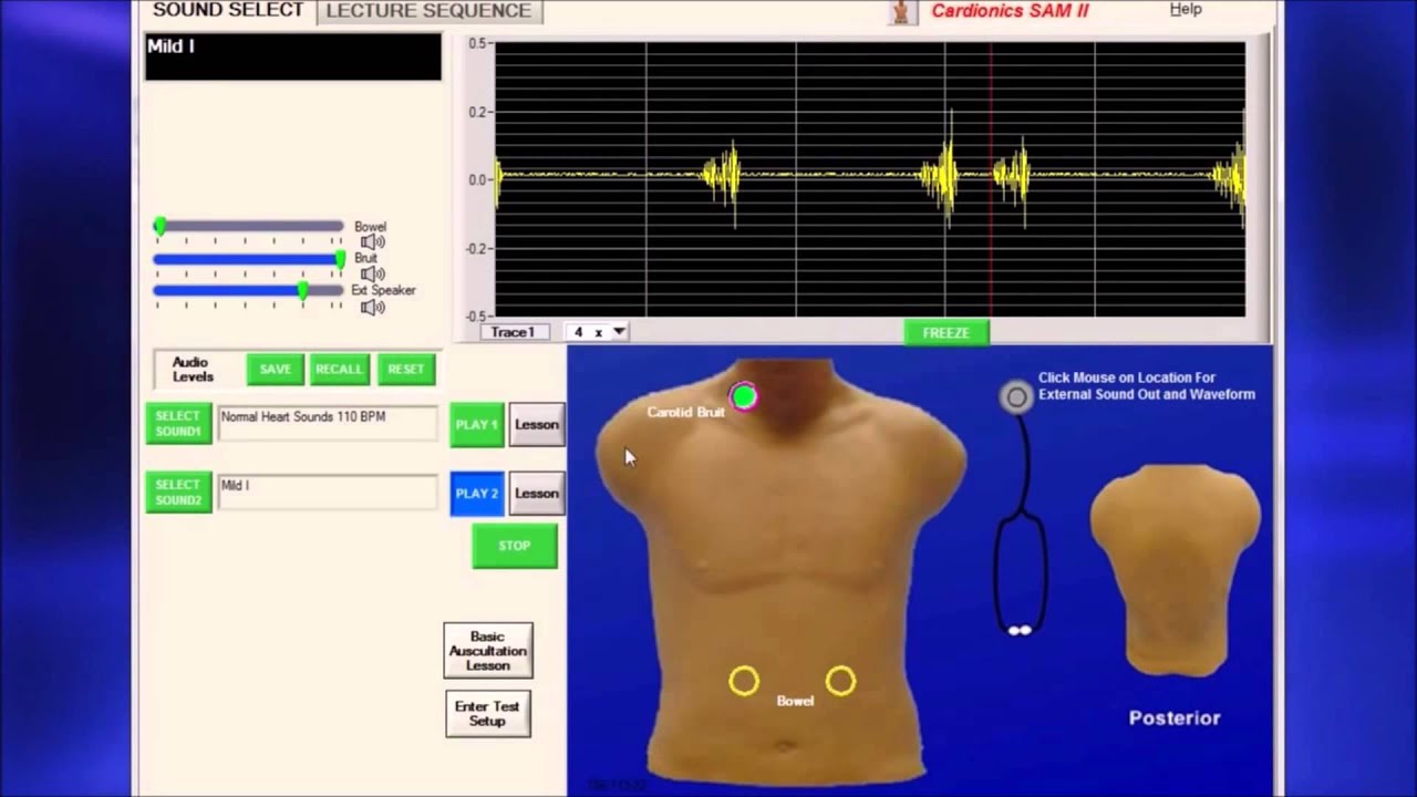 Cardionics SAM II การใช้งาน - YouTube
