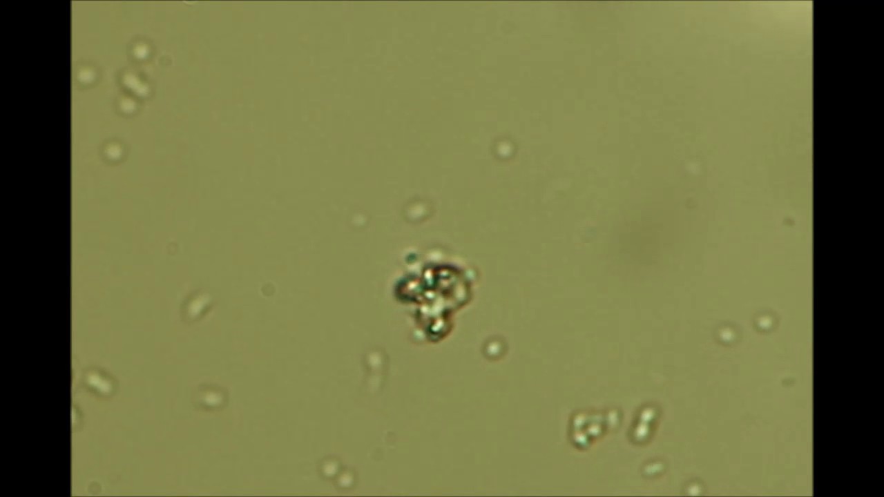 Optische Pinzette - Bakterien Transport - YouTube