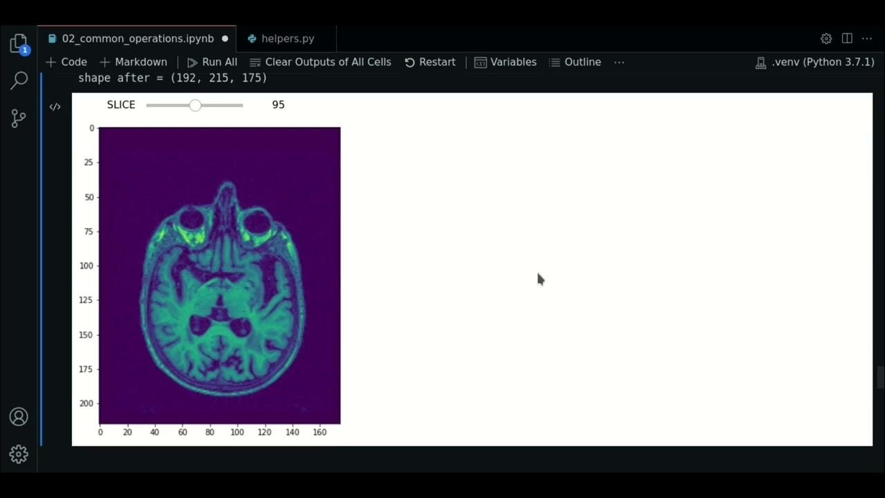 2.3 - Padding | SimpleITK - Course MRI preprocessing with Python - YouTube