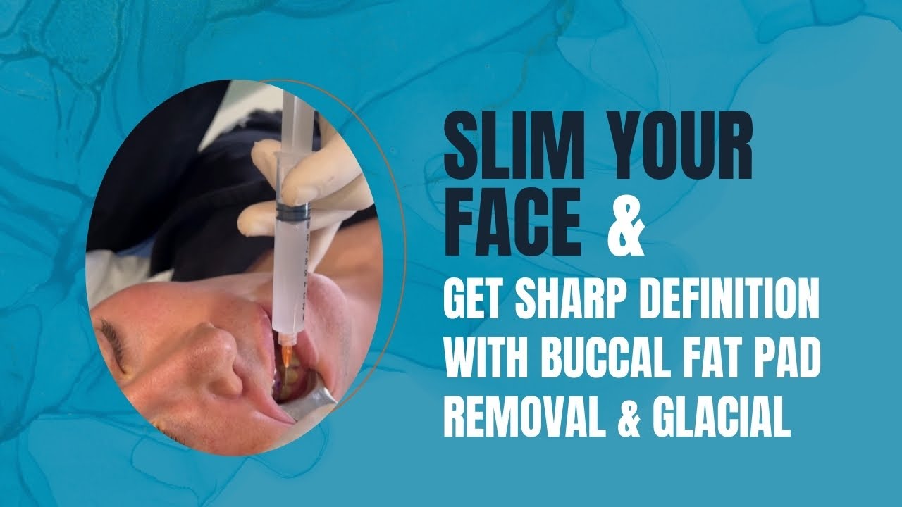 SLIM YOUR FACE & GET SHARP DEFINITION WITH BUCCAL FAT PAD REMOVAL ...