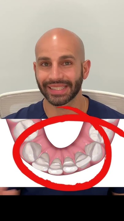 Permanent Retainers: Why We Don’t recommend Them for Our Patients - YouTube