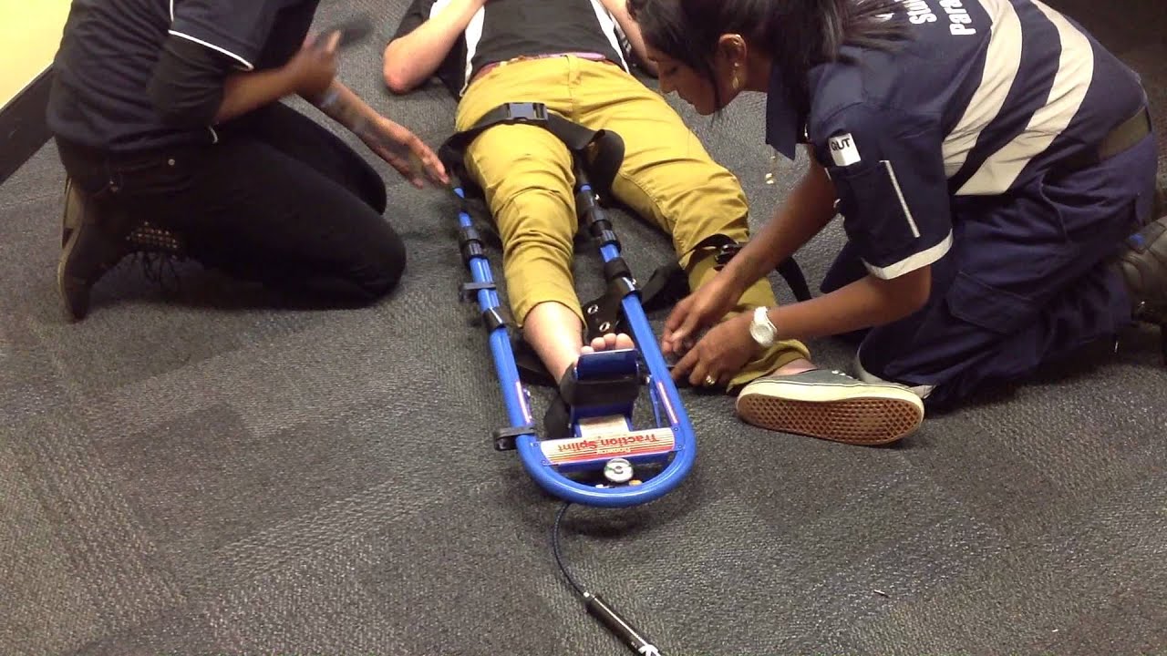 Group 24 - Donway Splint - YouTube