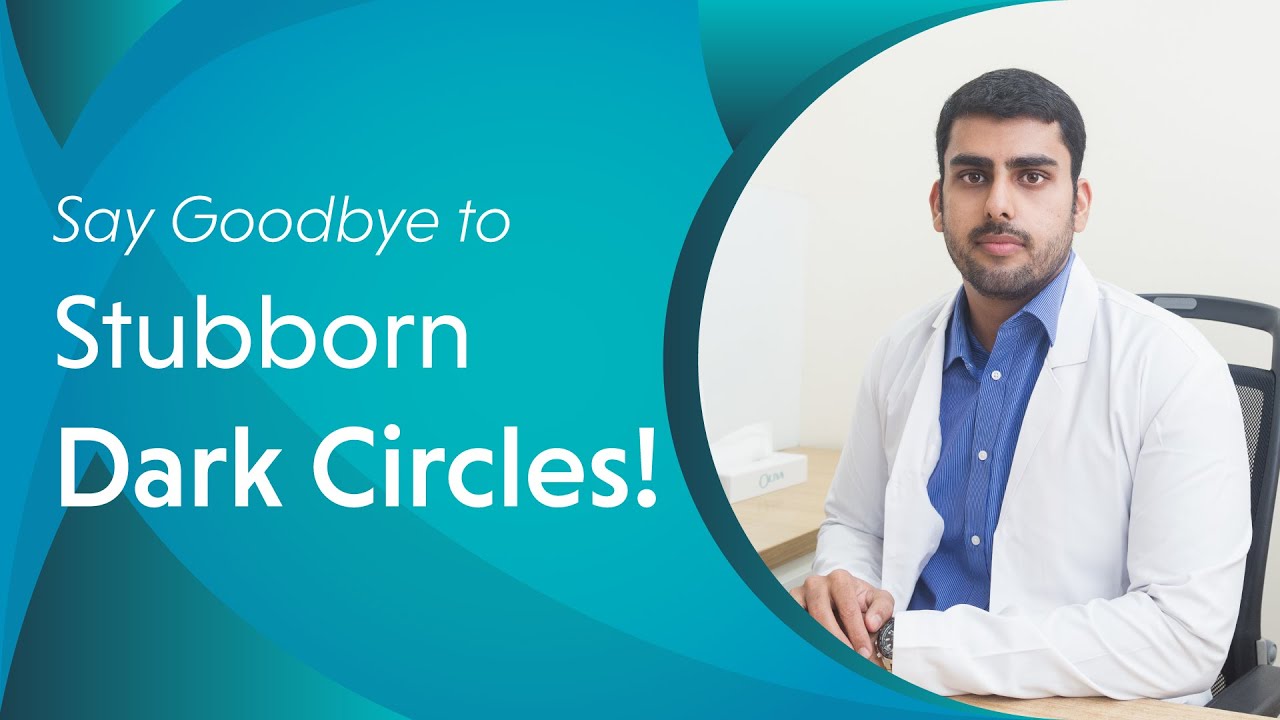 How to remove dark circles | Dark Circle Treatment Dr. Anoop Gopal DS ...