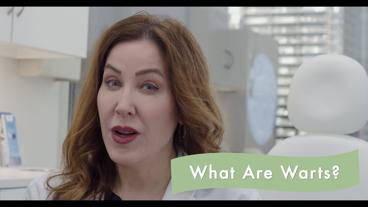 How to Treat Warts [Explained by a Dermatologist] - YouTube