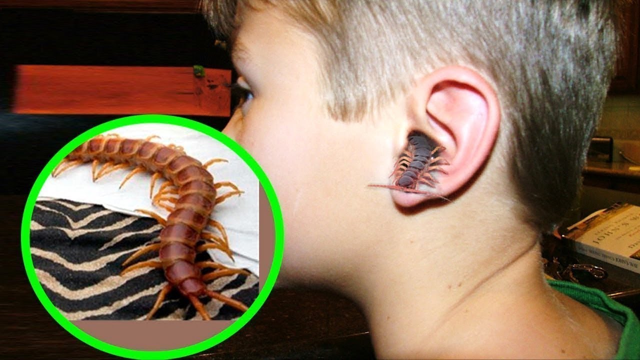 İnsan Vücuduna Girebilen KÜÇÜK canlılar - YouTube