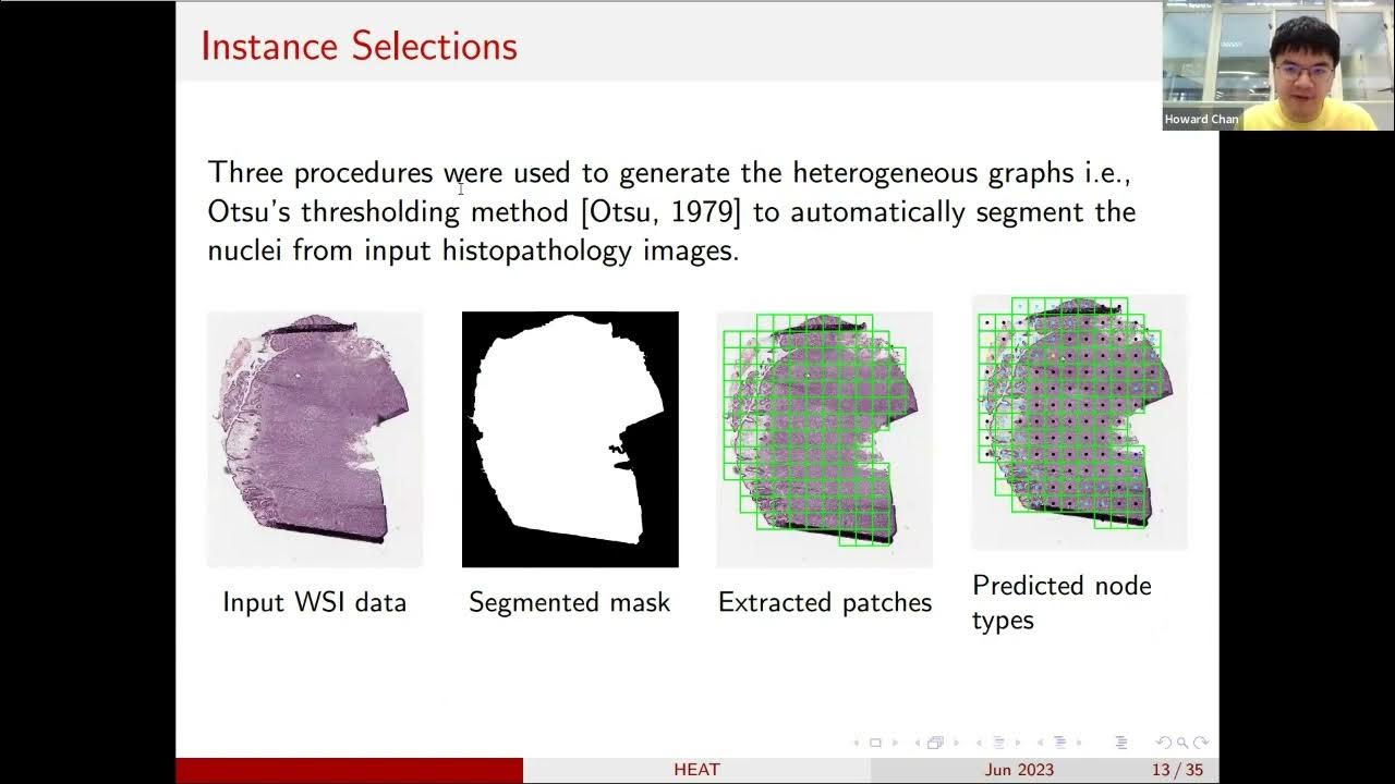 [CVPR_2023] Histopathology WSI Analysis with Heterogeneous Graph Representation Learning - YouTube