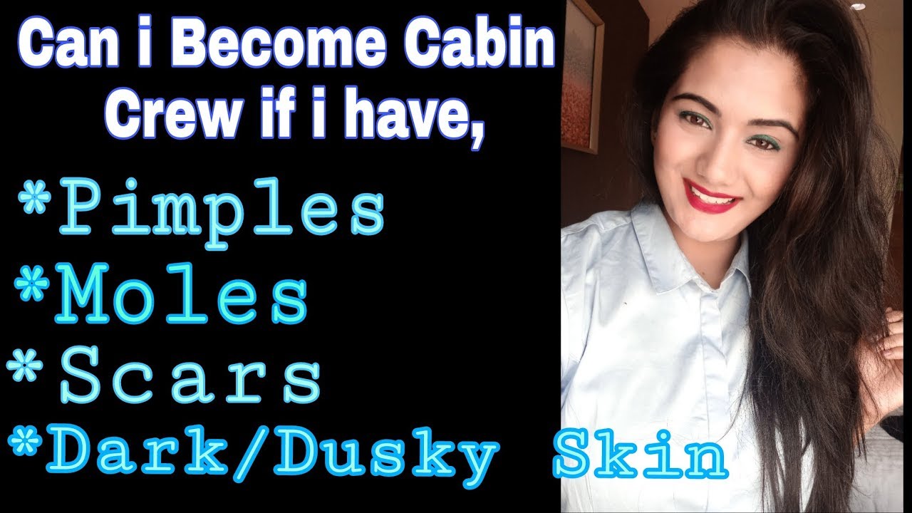 Can I become a Cabin Crew/Air Hostess if I have Moles, Pimples,Scars ...