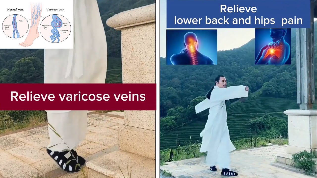 Relieve Varicose Veins * Relieve Lower Back, Hips, and Upper Back Pain ...