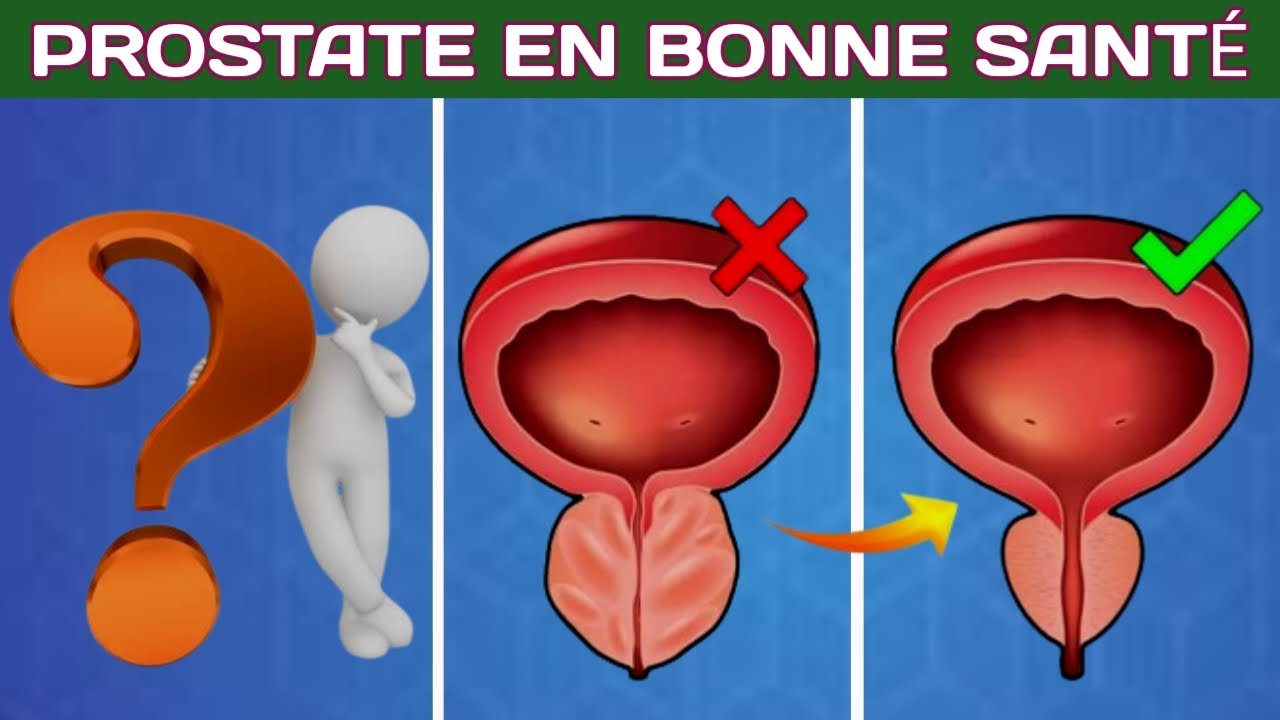 Les MEILLEURS Aliments pour une Prostate en Bonne Santé | Santé ...