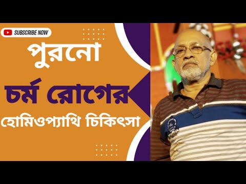 পুরনো চর্মরোগ | chronic skin disease | homoeopathy treatment | Dr Gopal ...