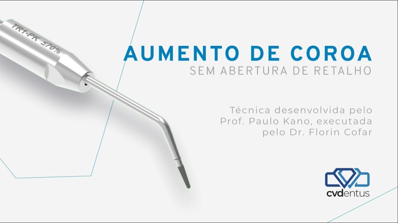 Flapless em ação | Florin Cofar - YouTube